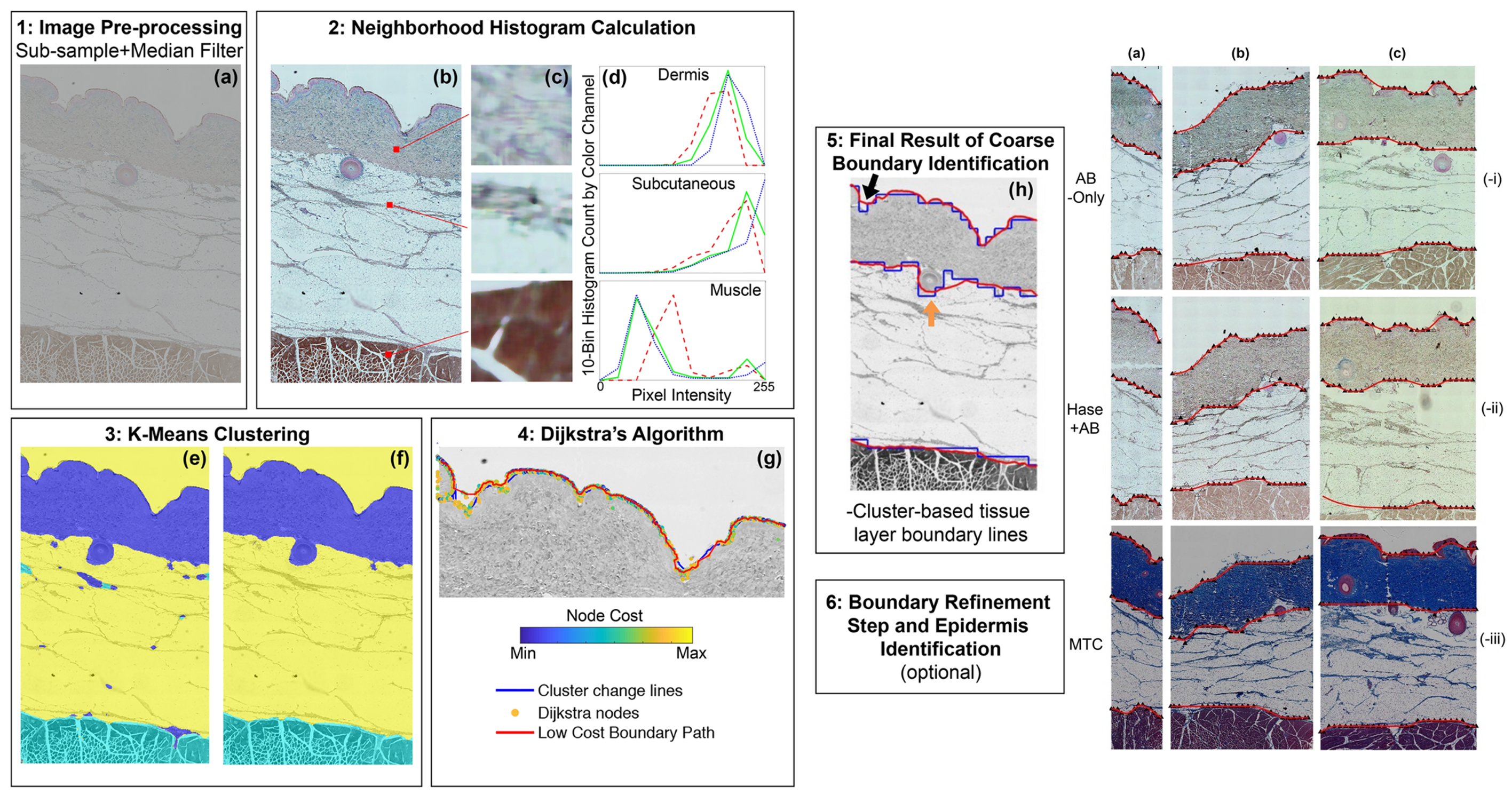 Vlachos Research Group | Automating Histology Analysis with a Novel ...